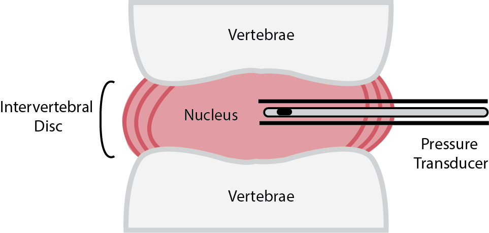 Millar Pressure Catheter | Airway, Spinal, and Tumor Pressure Measurement | ADInstruments